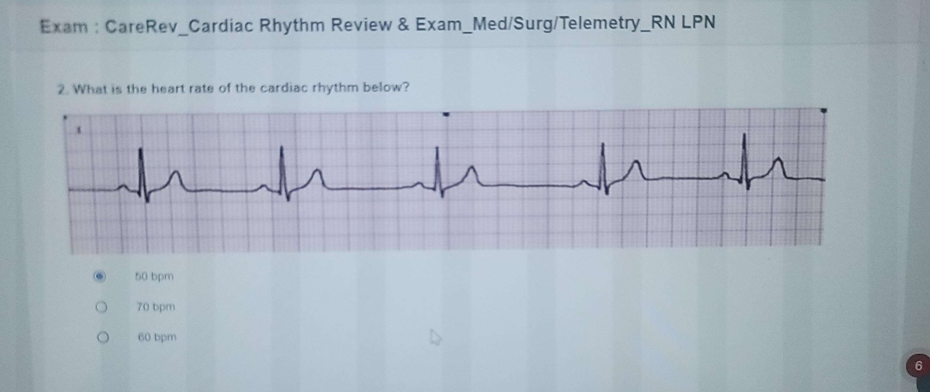Solved Exam : CareRev_Cardiac Rhythm Review & | Chegg.com
