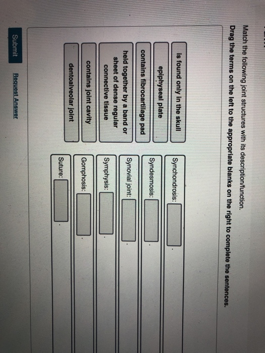 Solved Match the following joint structures with its | Chegg.com