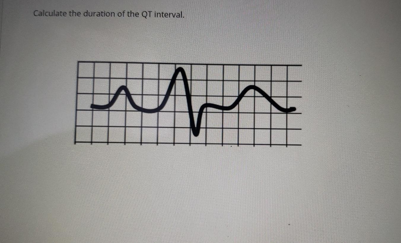 Solved Calculate the duration of the QT interval. WA | Chegg.com