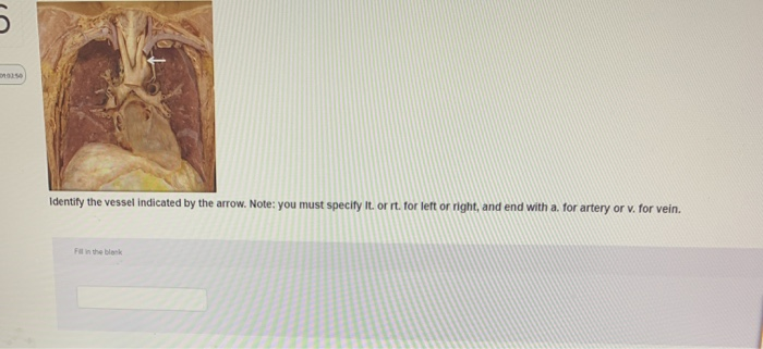 Solved Identify the vessel indicated by the arrow. Note: you | Chegg.com