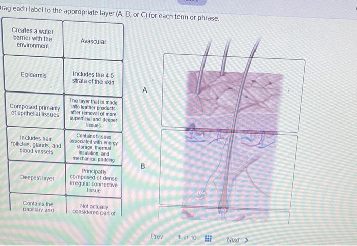Solved In the micrograph of pigmented skin, identify the | Chegg.com