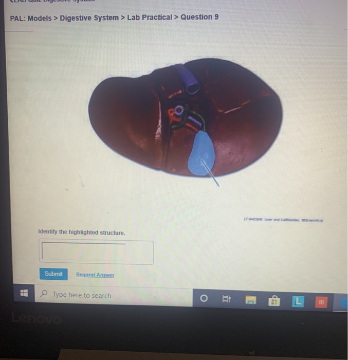 SLAUGUL U LO PAL: Models > Digestive System > Lab | Chegg.com