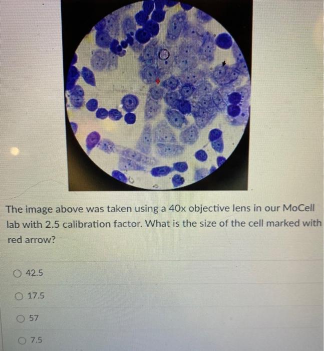 Solved The image above was taken using a 40 x objective lens | Chegg.com