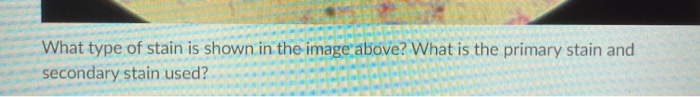 Solved What type of stain is shown in the image above? What | Chegg.com