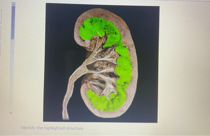 Solved Identify the highlighted structure 3 6 9 Identify | Chegg.com