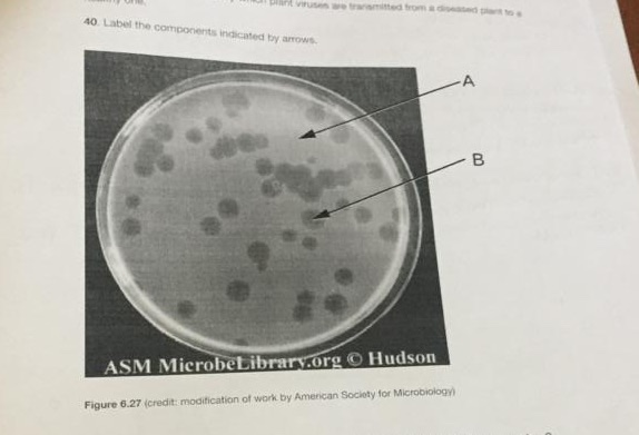 Solved 40. Label the components indicated by Grow A B ASM | Chegg.com