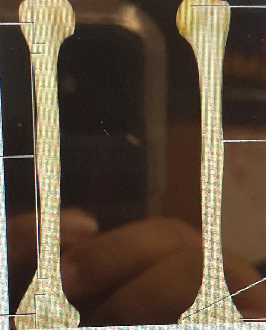 Solved Label the structures of the bone | Chegg.com