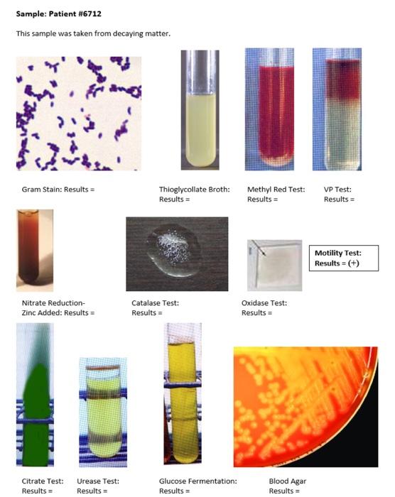 Solved identify the unknown bacteria. sample was taken from | Chegg.com