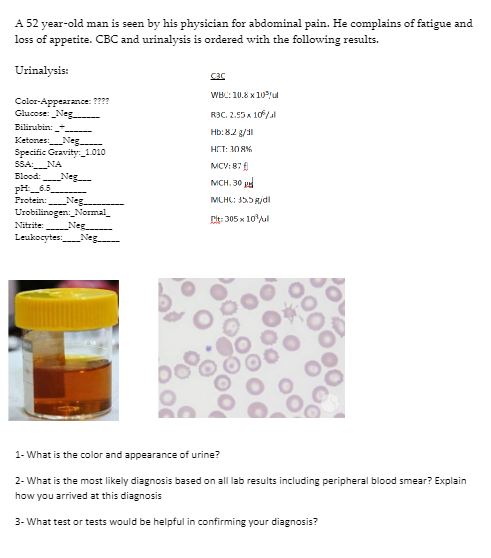 Solved 1- ﻿What is the color and appearance of urine?2- | Chegg.com