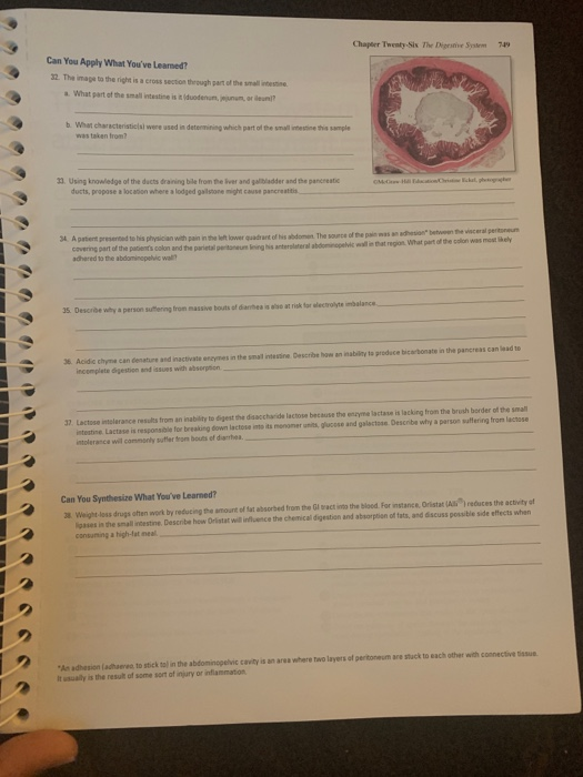 Solved Chapter 26: The Digestive System These Pre-Laboratory | Chegg.com