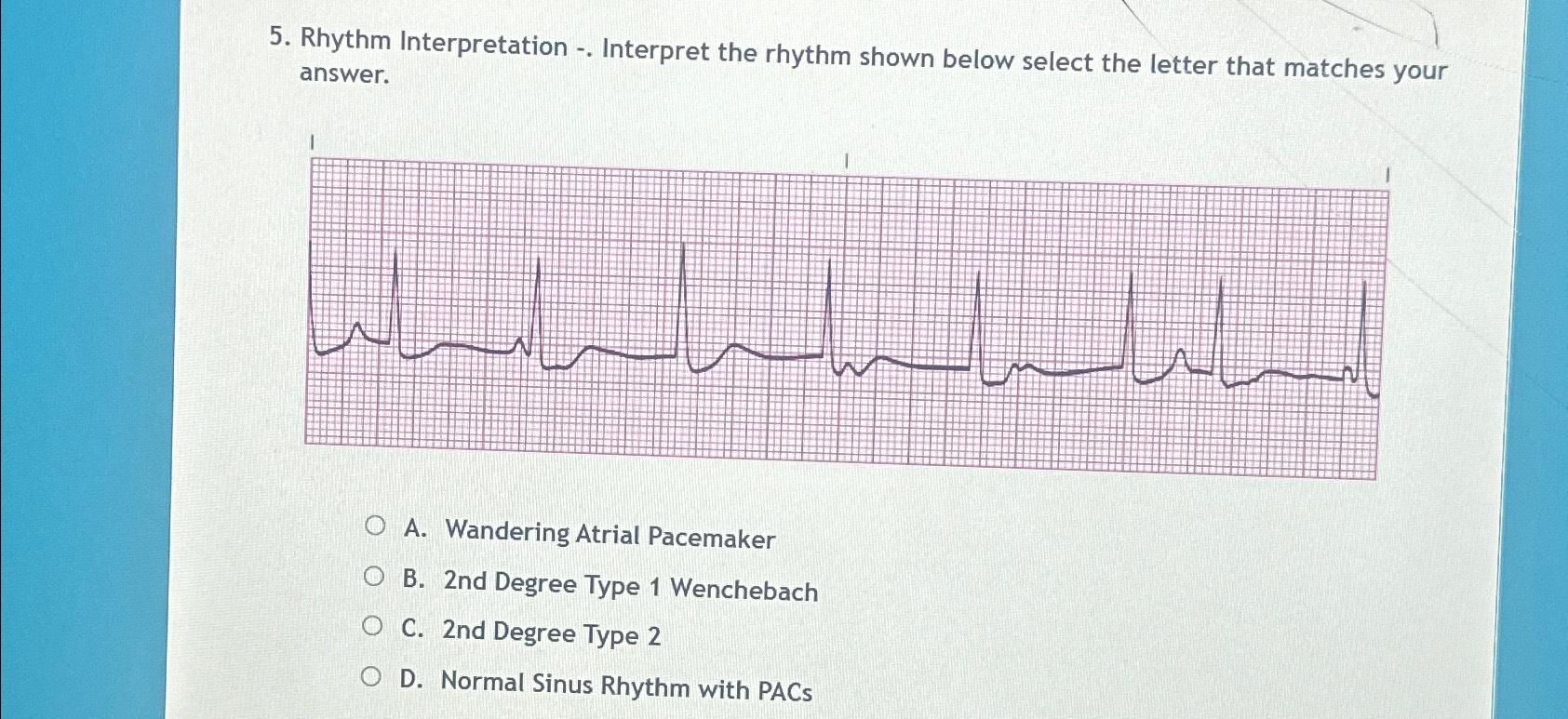 Solved Rhythm Interpretation -. ﻿Interpret the rhythm shown | Chegg.com