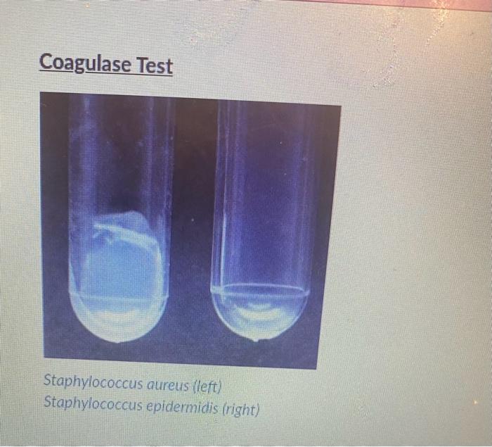 Solved 2. To test for the presence of coogulase. a tube of | Chegg.com