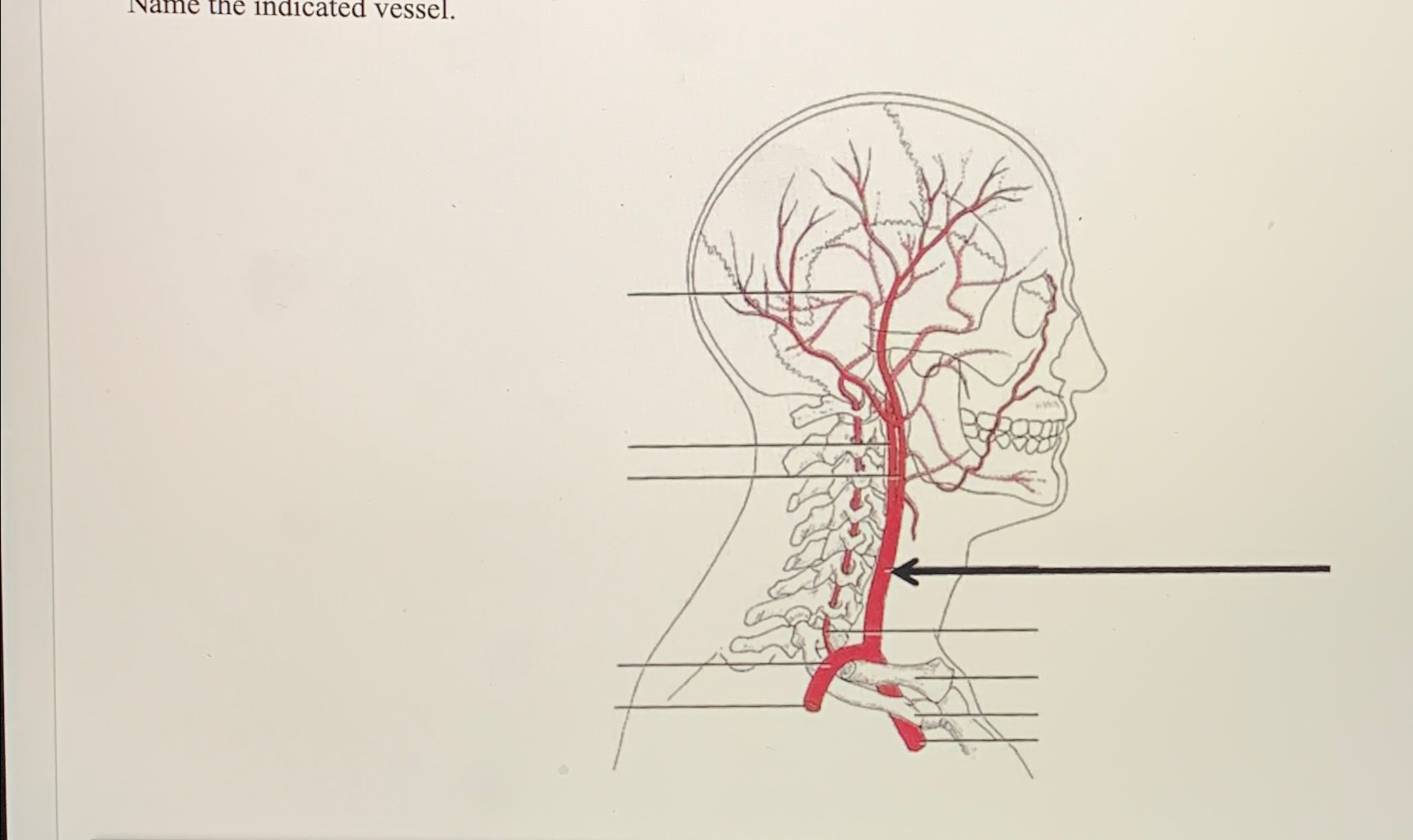 Solved name the indicated vessel | Chegg.com