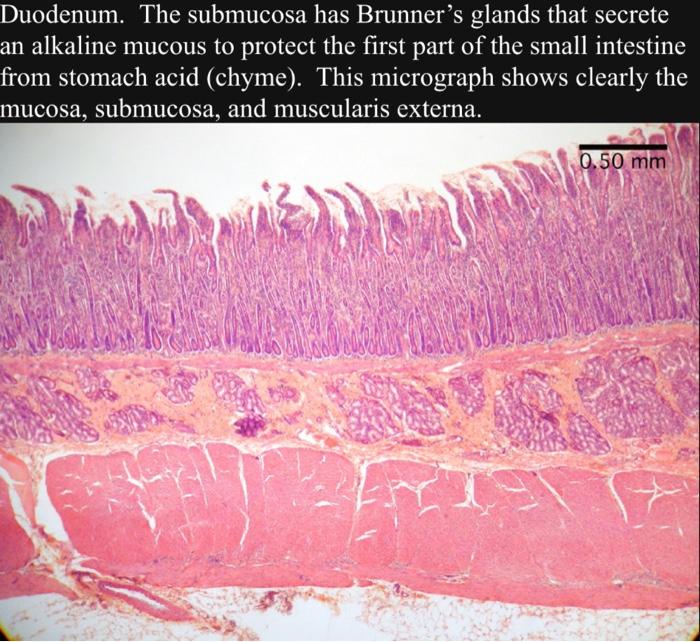 A. Duodenum 1.Examine the microscopic slide of the | Chegg.com