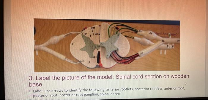 Solved 2. Label the picture of the model: Spinal cord and | Chegg.com
