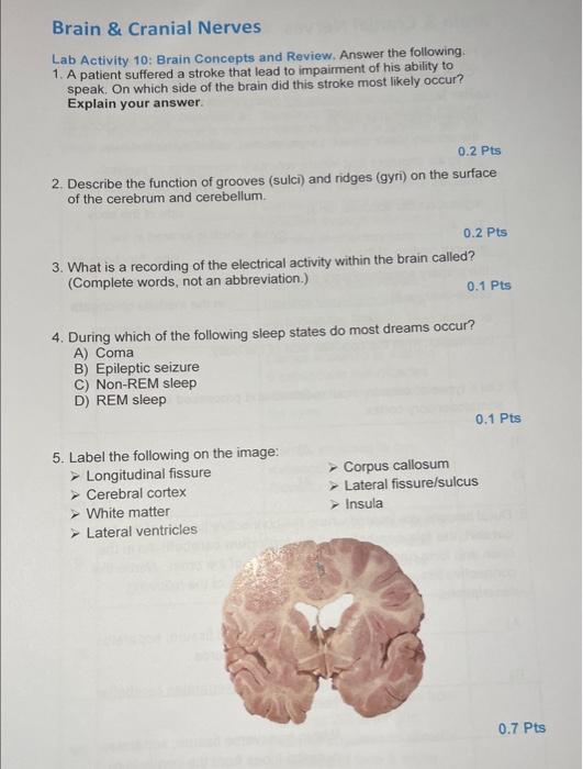 Solved Lab Activity 10: Brain Concepts and Review, Answer | Chegg.com Solved Lab Activity 10: Brain Concepts and Review, Answer | Chegg.com