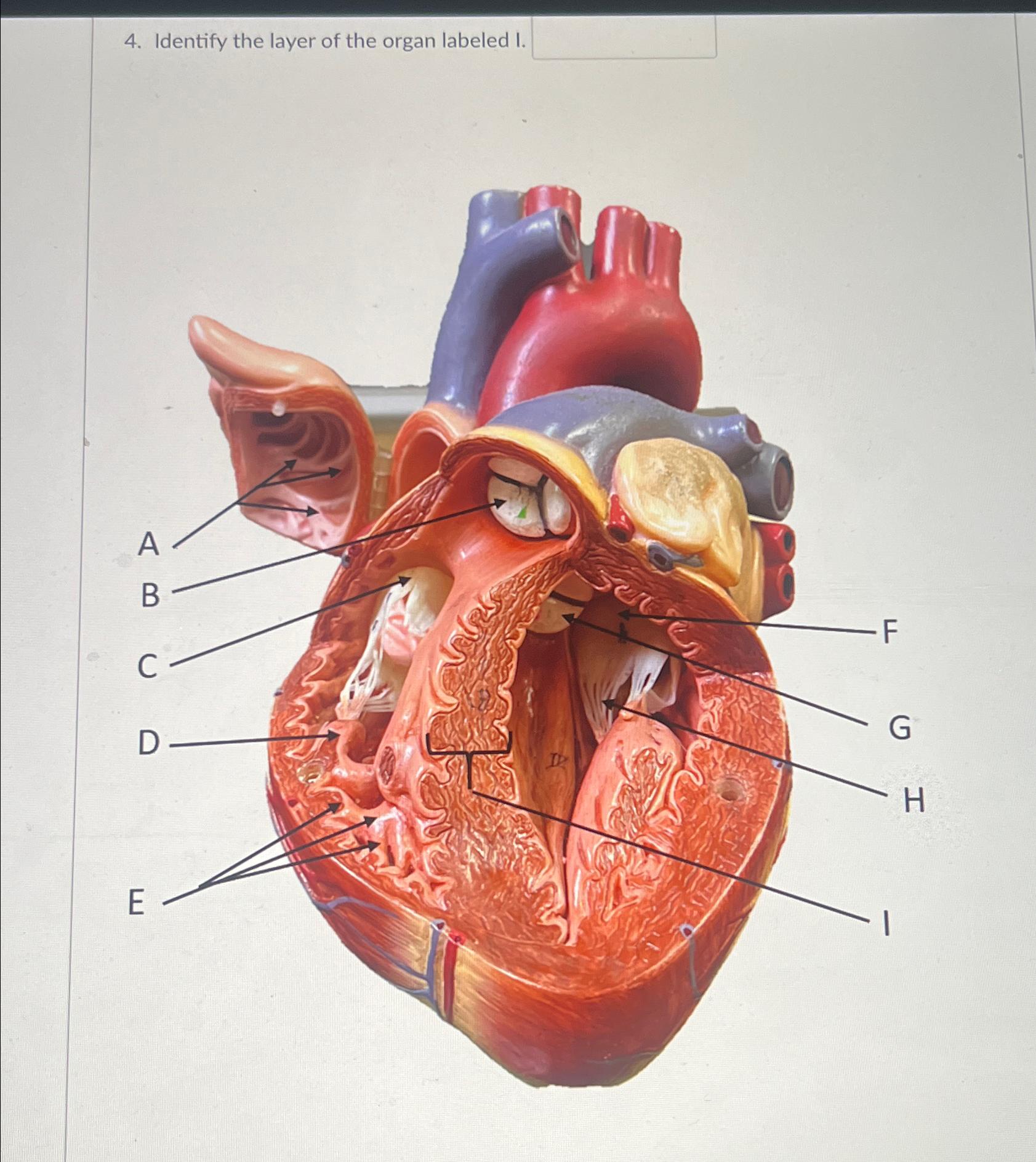 Solved identify the layer of the organ labeled I | Chegg.com