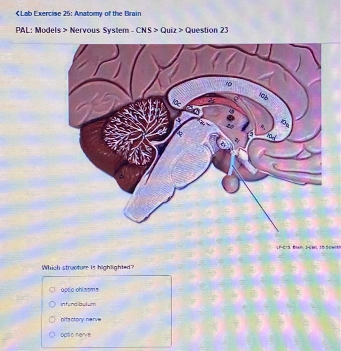 Solved Nervous System: CNS > Quiz > Question 19 Which | Chegg.com