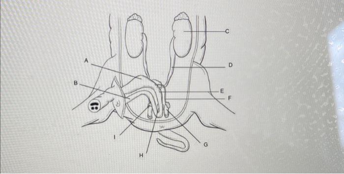 Solved Use the following terms below to label the URINARY | Chegg.com