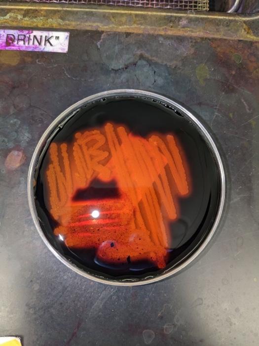 Solved This is for Microbiology.Starch & nutrient agar. | Chegg.com