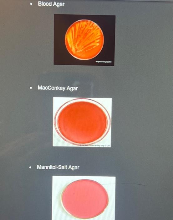Solved Record your observstions of Streptococcus pyogenes | Chegg.com