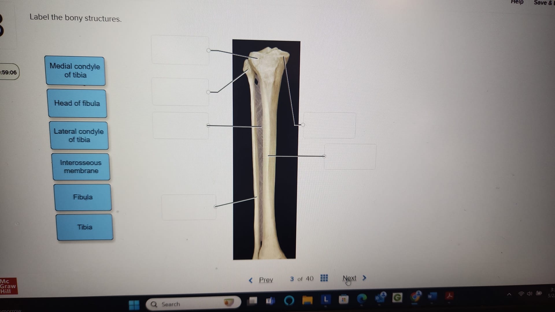 Solved Label the bony structures. | Chegg.com Solved Label the bony structures. | Chegg.com