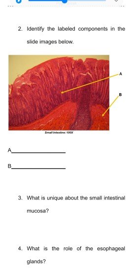 Solved 10:11 S.58% Osa Labó-Digestive-S... + Not saved yet | Chegg.com Solved 10:11 S.58% Osa Labó-Digestive-S... + Not saved yet | Chegg.com