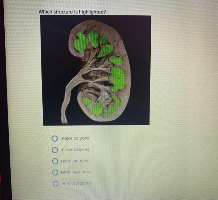 Solved Which structure is highlighted? O major calyces minor | Chegg.com