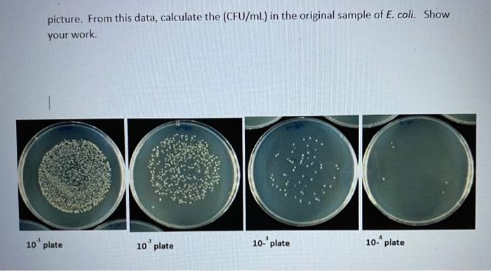 Solved 5. (1 pt) Putting it all together: A) A bacterial | Chegg.com