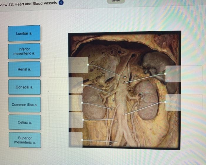 Solved Saved Saved Review #3: Heart and Blood Vessels Label | Chegg.com