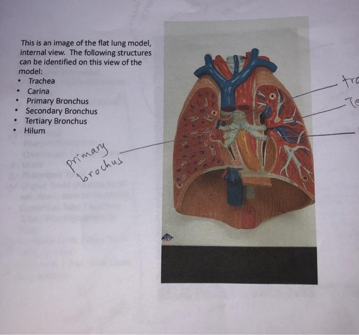 Solved This is an image of the flat lung model, internal | Chegg.com