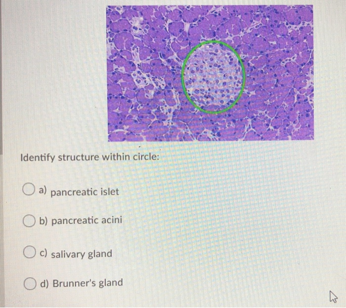 Solved Identify structure within circle: a) pancreatic islet | Chegg.com