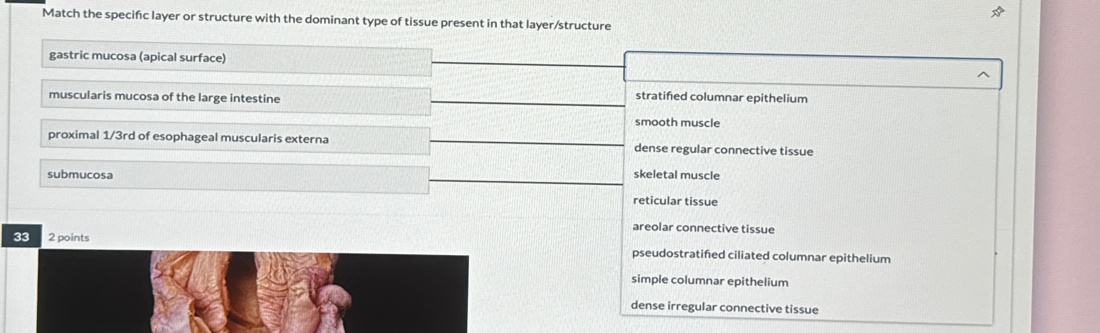 Solved Match the specific layer or structure with the | Chegg.com
