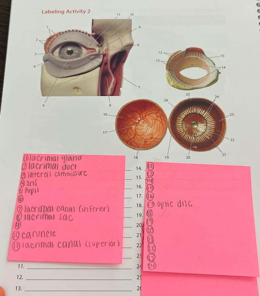 Solved 16 - (1acrimal gland 25 23 (2) lacrimal duct Q | Chegg.com