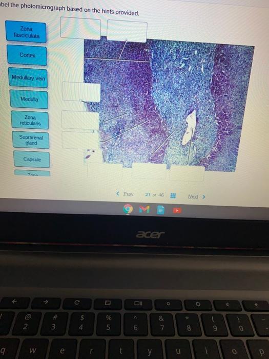 Solved bel the photomicrograph based on the hints provided. | Chegg.com