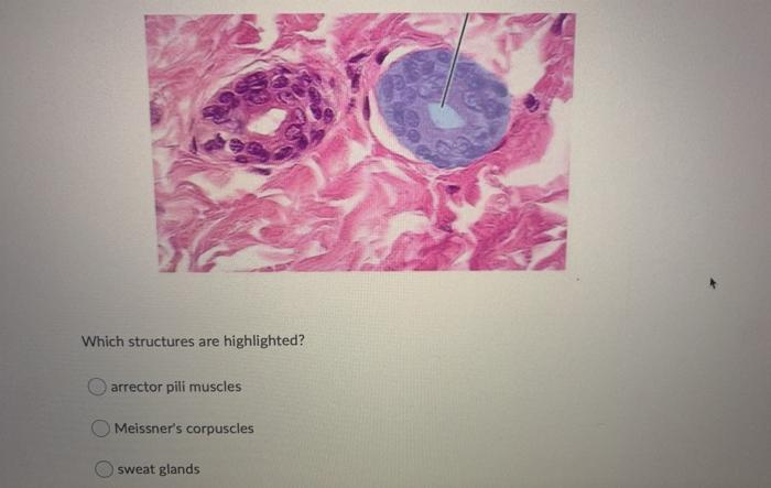 Solved Which structures are highlighted? O arrector pili | Chegg.com