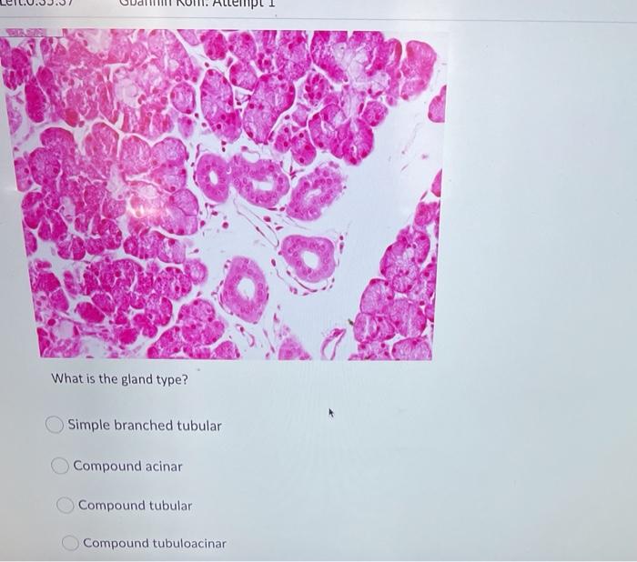 Solved What is the gland type? Simple branched tubular | Chegg.com