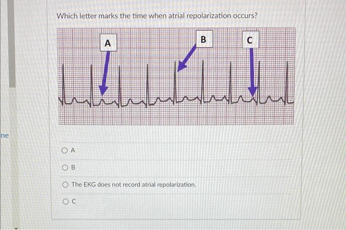 Solved Which letter marks the time when atrial | Chegg.com