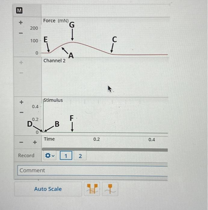 Solved In the figure above, to measure the contraction | Chegg.com