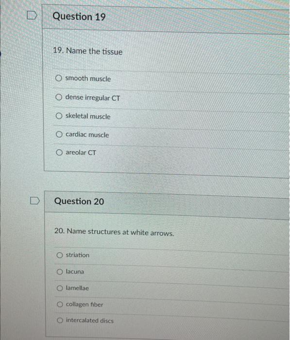 Solved 19.- Name the tissue 20.- Name the white | Chegg.com