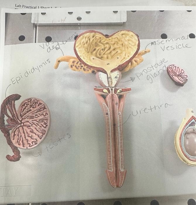 Solved did i label these correctly? please help thank you | Chegg.com
