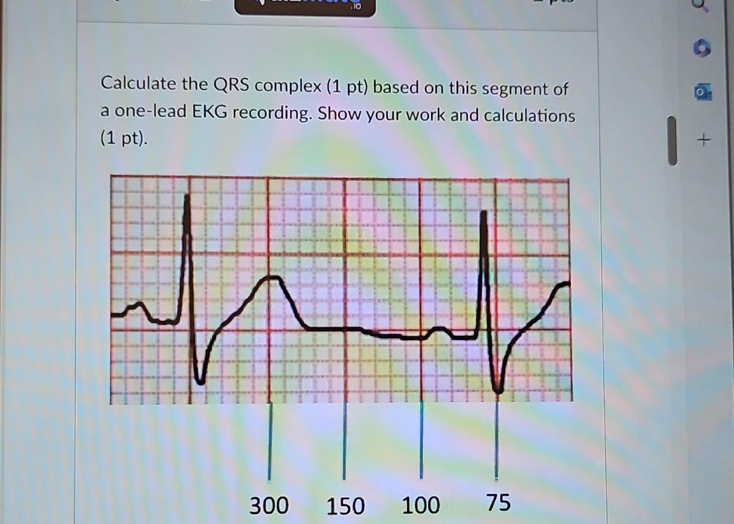 Solved Calculate the QRS complex (1 pt) based on this | Chegg.com