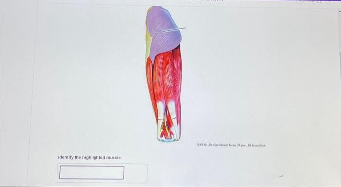 identify the highlighted muscle. | Chegg.com