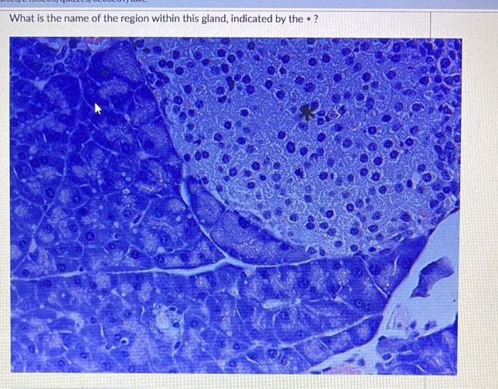 Solved what is the name of the region within this gland, | Chegg.com