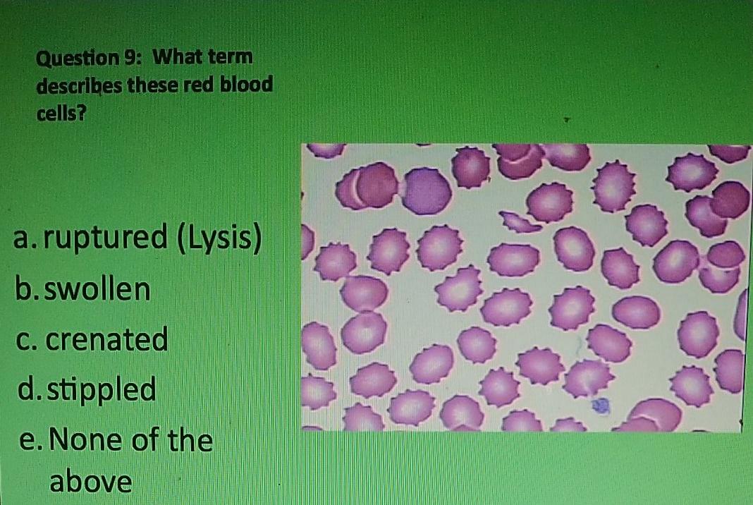 Solved Question 9: What term describes these red blood | Chegg.com