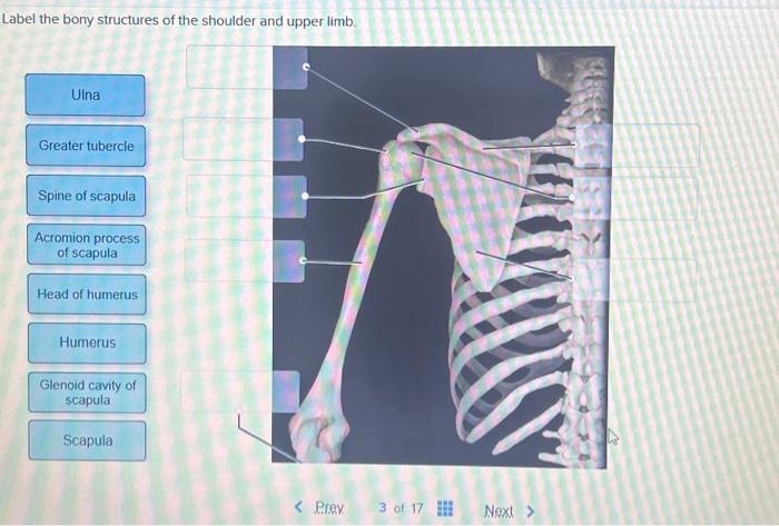 Solved Label the bony structures of the shoulder and upper | Chegg.com
