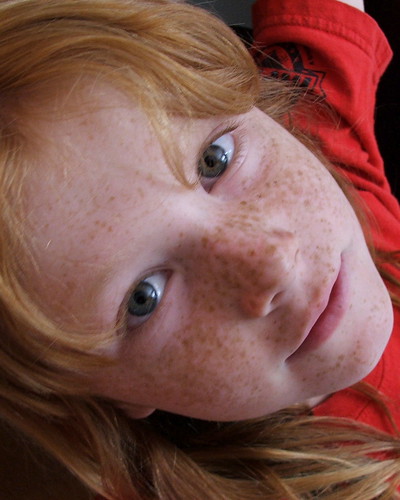 Solved Freckles show a dominant inheritance pattern. What is | Chegg.com