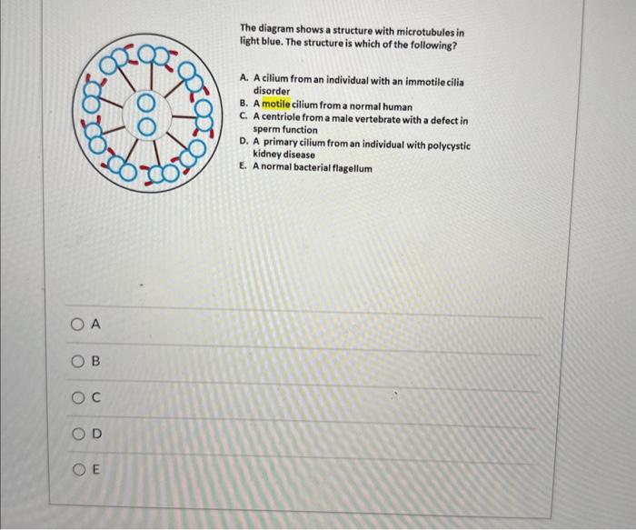 Solved The diagram shows a structure with microtubules in | Chegg.com