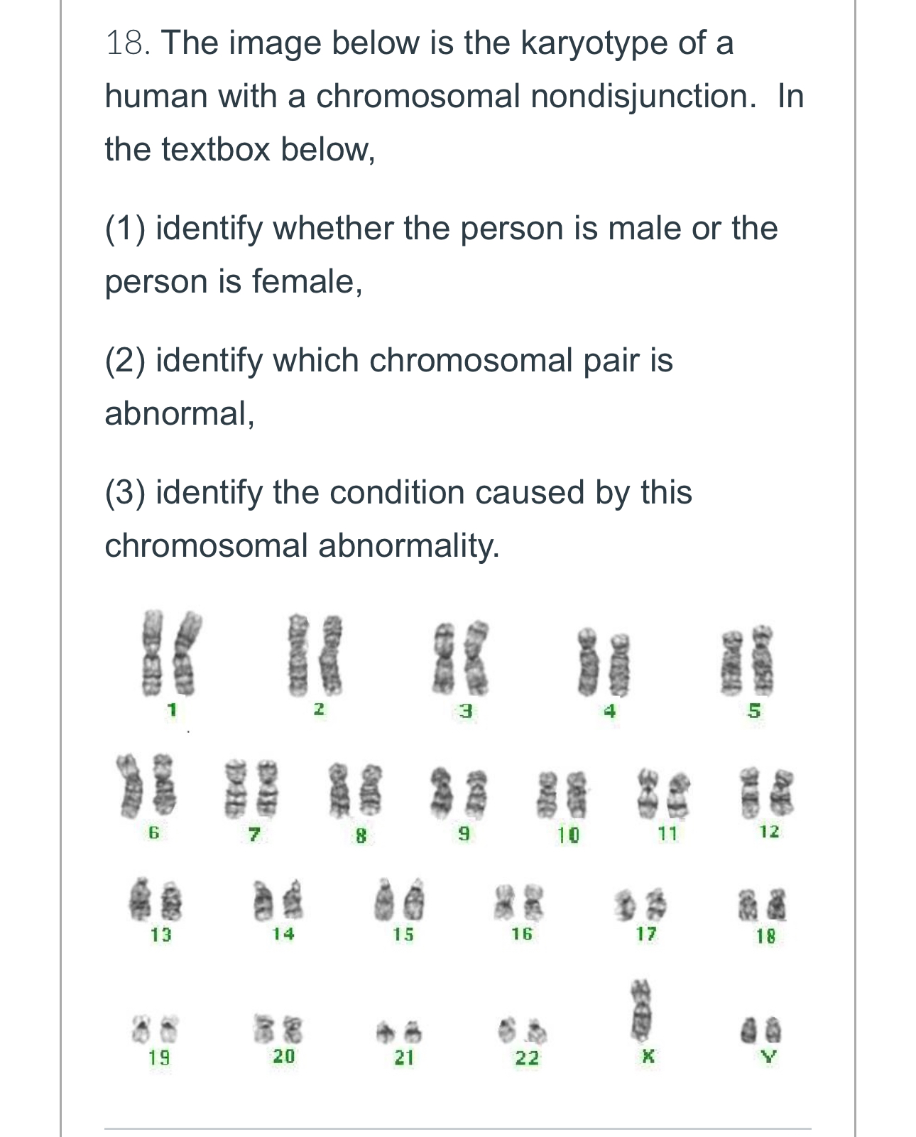 Solved The image below is the karyotype of a human with a | Chegg.com