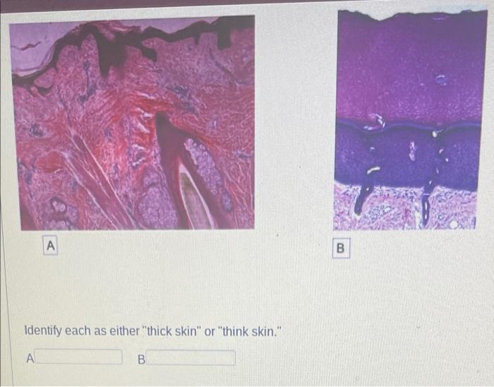 Solved A B Identify each as either "thick skin" or "think | Chegg.com